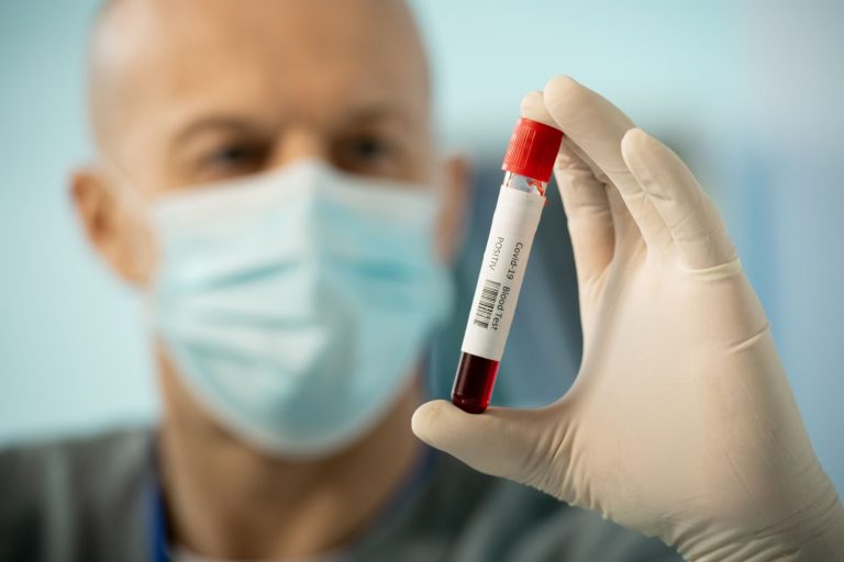 How Long Does Cocaine Stay in Your System? -Key Factors and 4 Common Tests